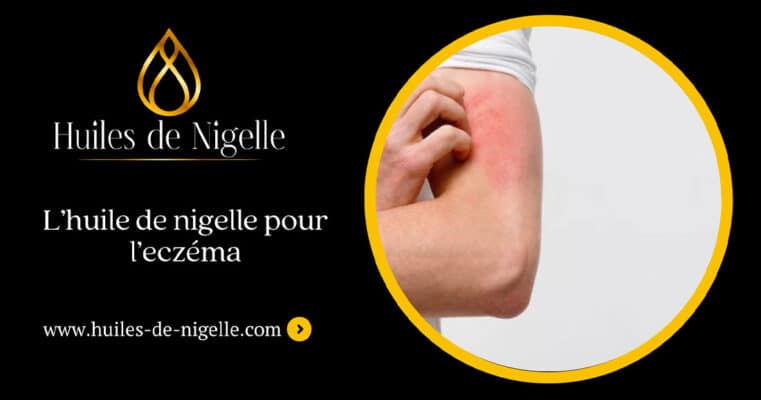 Huile de nigelle eczéma I Bienfaits nombreux pour la peau